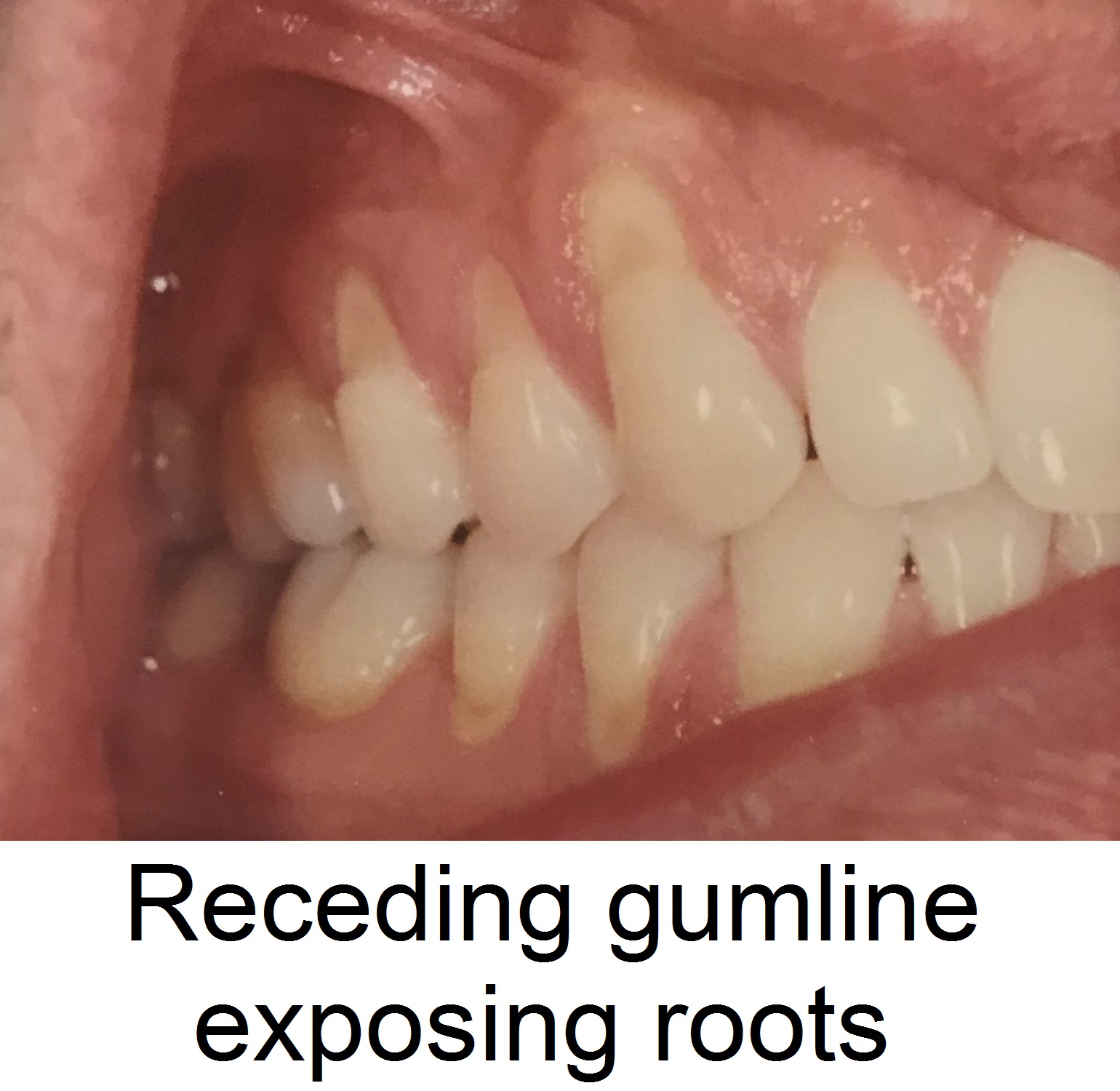 Round Rock Periodontics – Steven Milman DDS | Ali Arastu DDS Soft ...